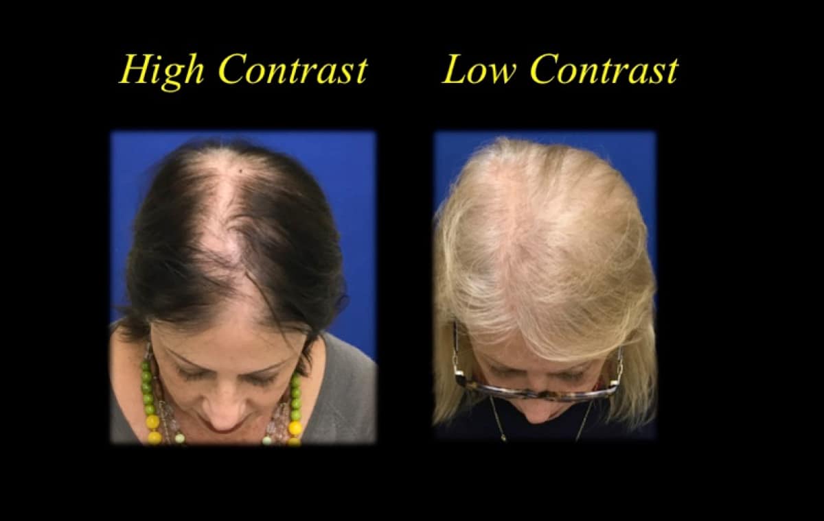 Reminder: Visual Dynamics of Hair Contrast